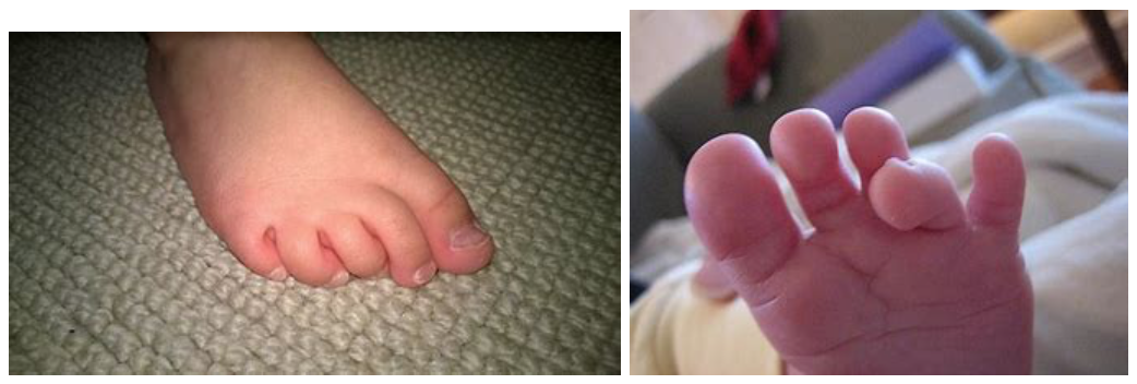 Arlington Heights Podiatry Services – Podiatry of Arlington Heights